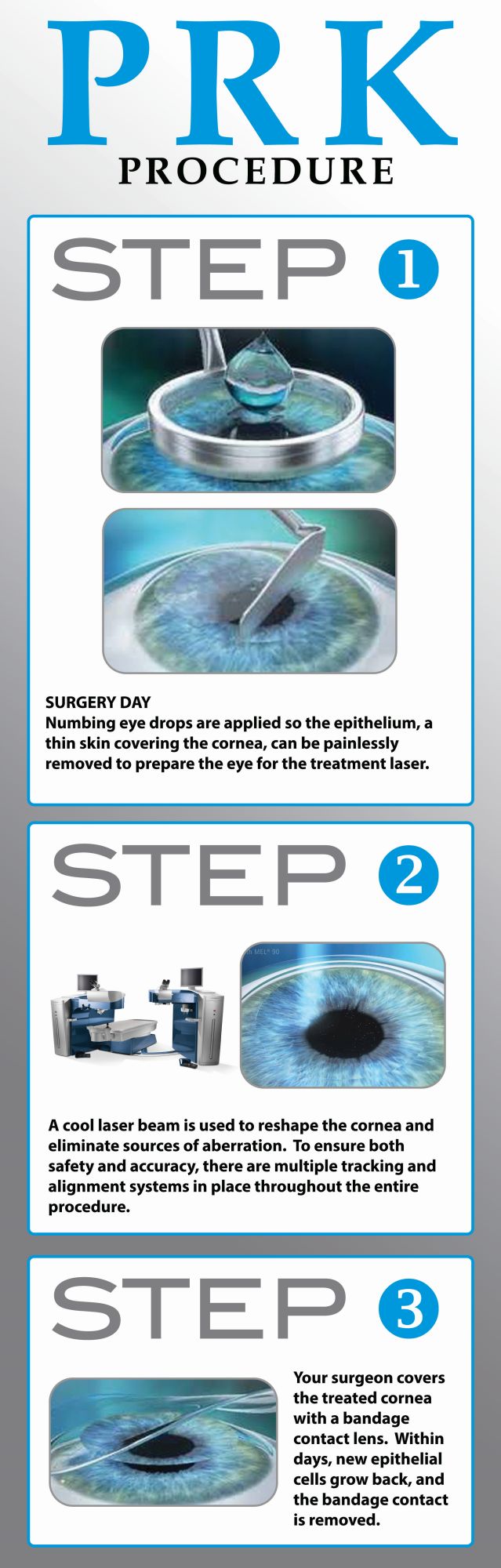 PRK | LASIK Alternative | Vision Correction Surgery